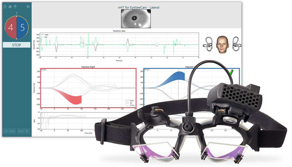 EyeSeeCam vHIT - EyeSeeTec GmbH